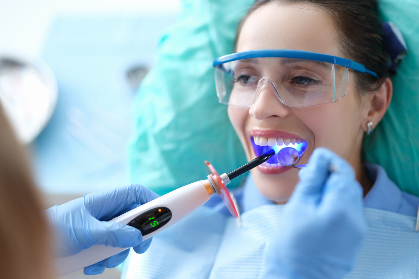 Composite Dental Fillings in Las Vegas, NV | Dee For Dentist