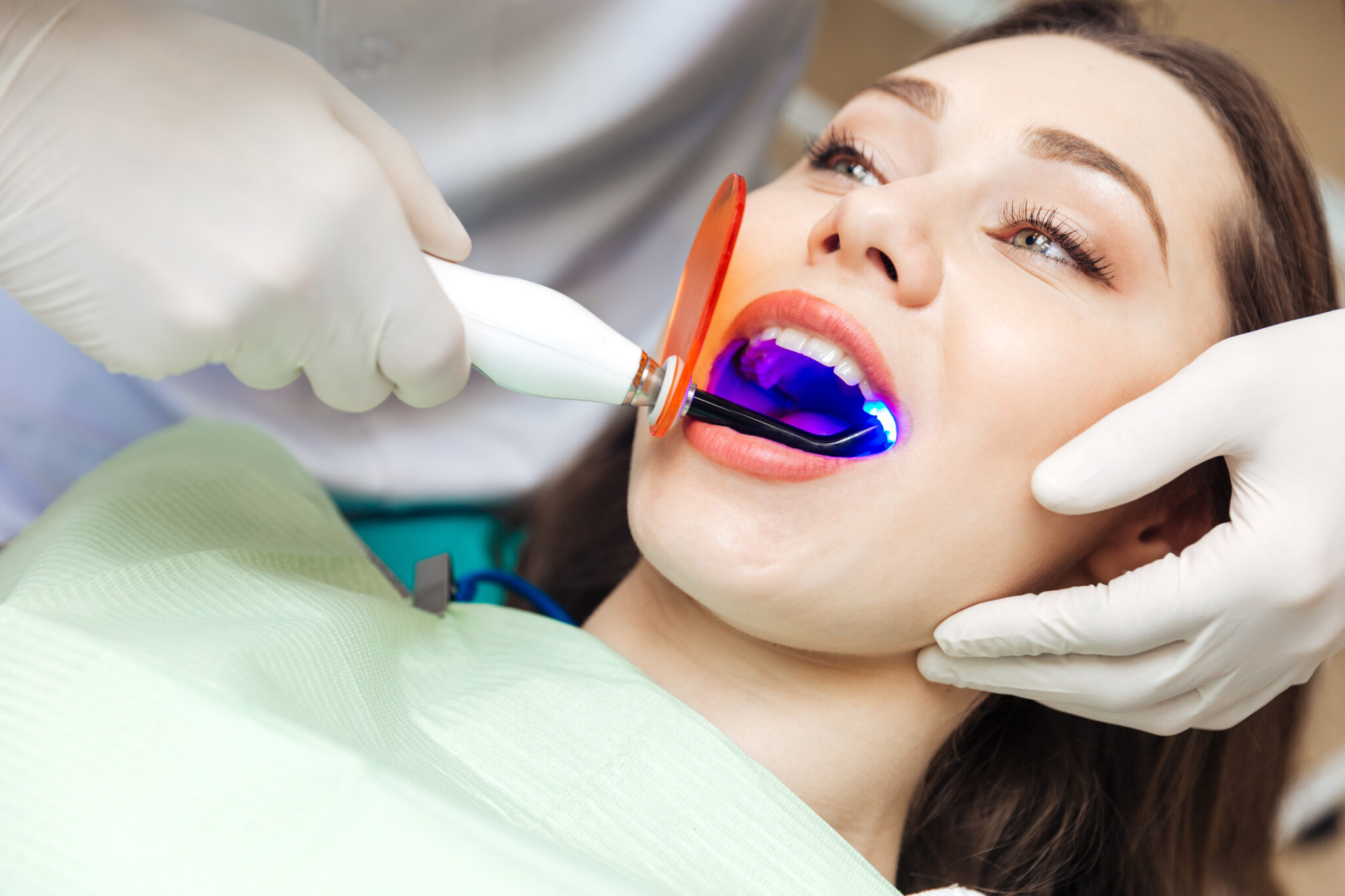 What Makes Solea Laser Fillings Different from Traditional Drilling ...